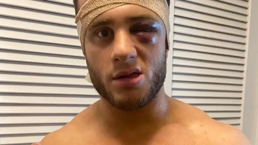 MJF Shows Off Nasty Injury Following AEW Revolution